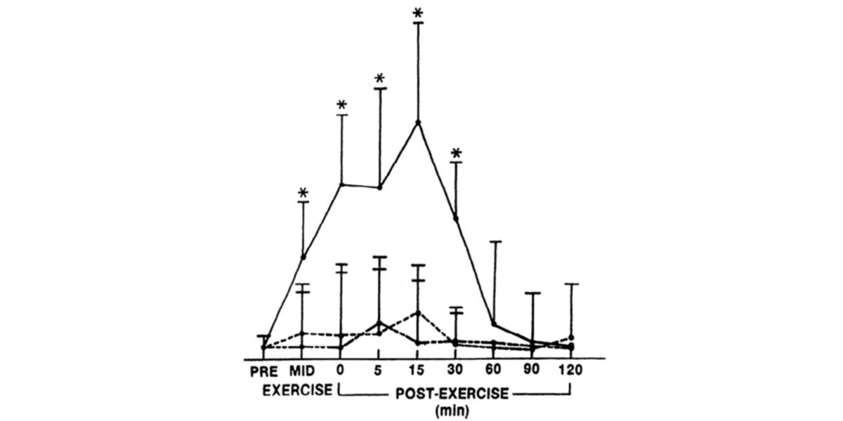 Rest Between Sets - For Hypertrophy, Strength or Circuit Training