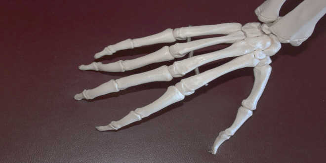 MSM - support against pain, inflammation, and allergy