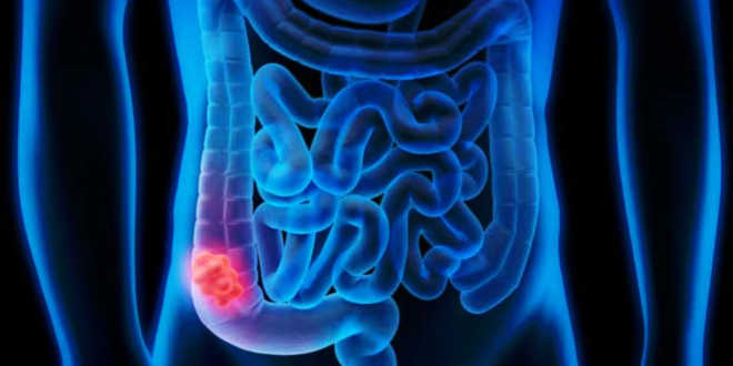 Things that can damage the intestinal flora - HSN Blog