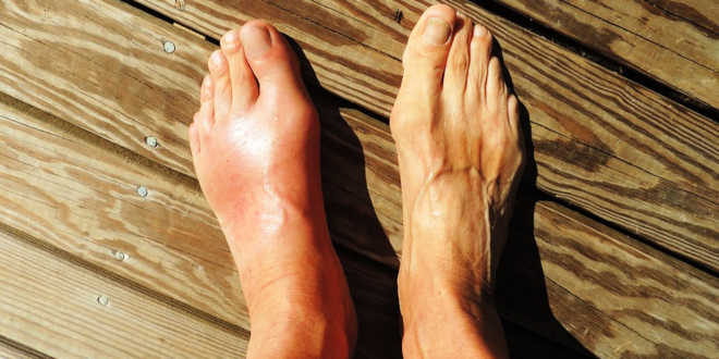 Devil's Claw - Properties and Benefits of Harpagophytum