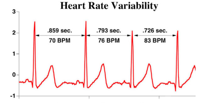 Heart Rate Variability - How to Interpret it?【2025