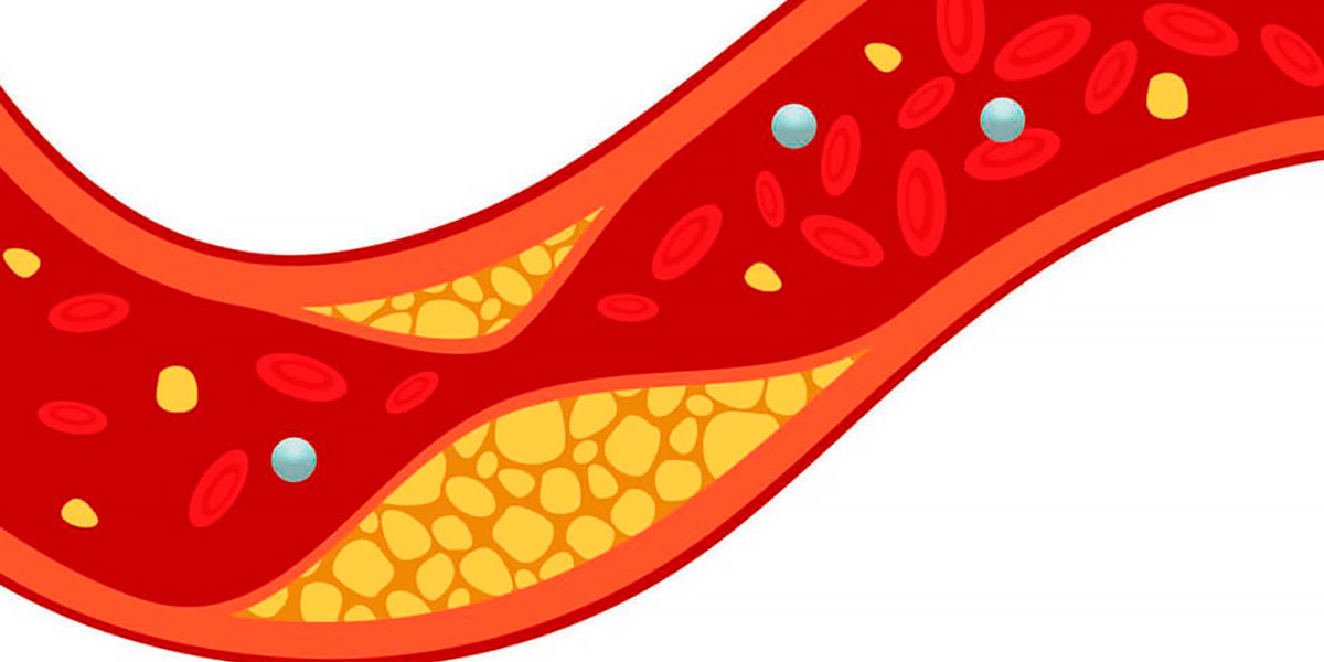 How to Interpret a Blood Analysis – What You Need to Know【HSN Blog】