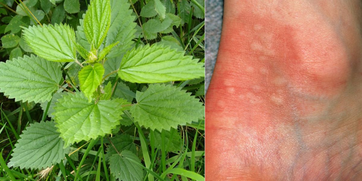 Nettle Root Extract: Uses and Benefits of this Healing Plant