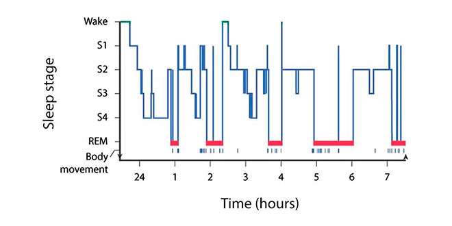Improve your diet with foods that will make you sleep better
